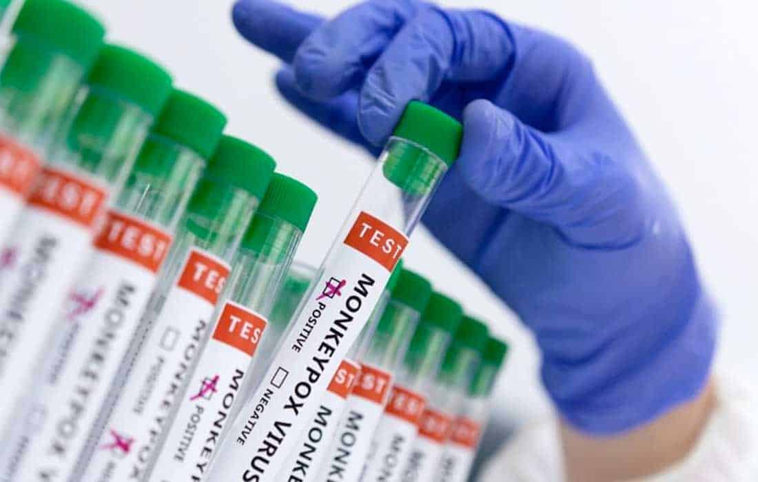 WHO launches 6-month plan to stop mpox transmission