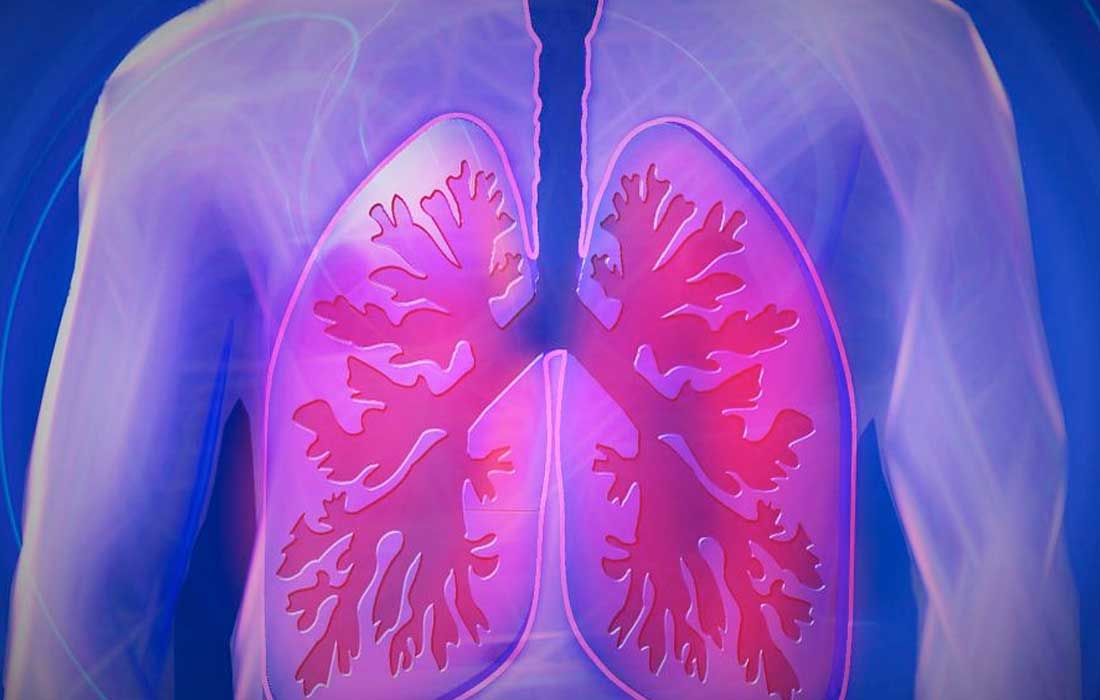 M42 AI excels in tuberculosis screening