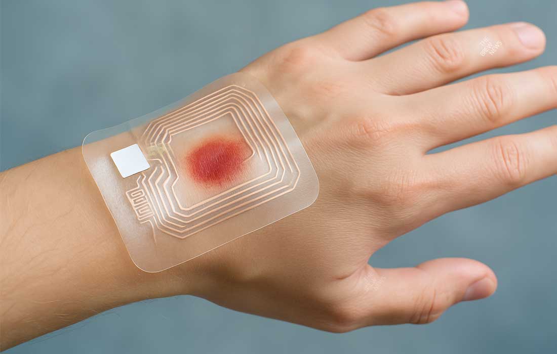 Smart healing bandage speeds recovery 4x